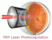 Mukherjee Eye Klinik :: Diabetic Retinopathy